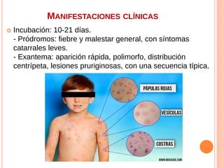 eruptivas de la infancia | PDF