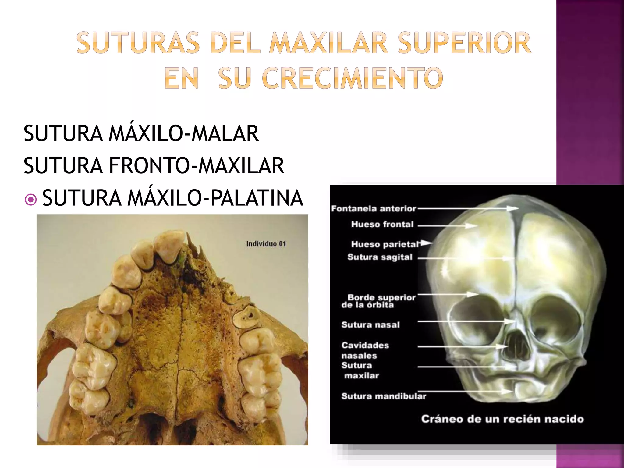 Exposicion de desarrollo del maxilar superior | PPTX
