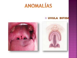 Exposicion de desarrollo del maxilar superior | PPTX