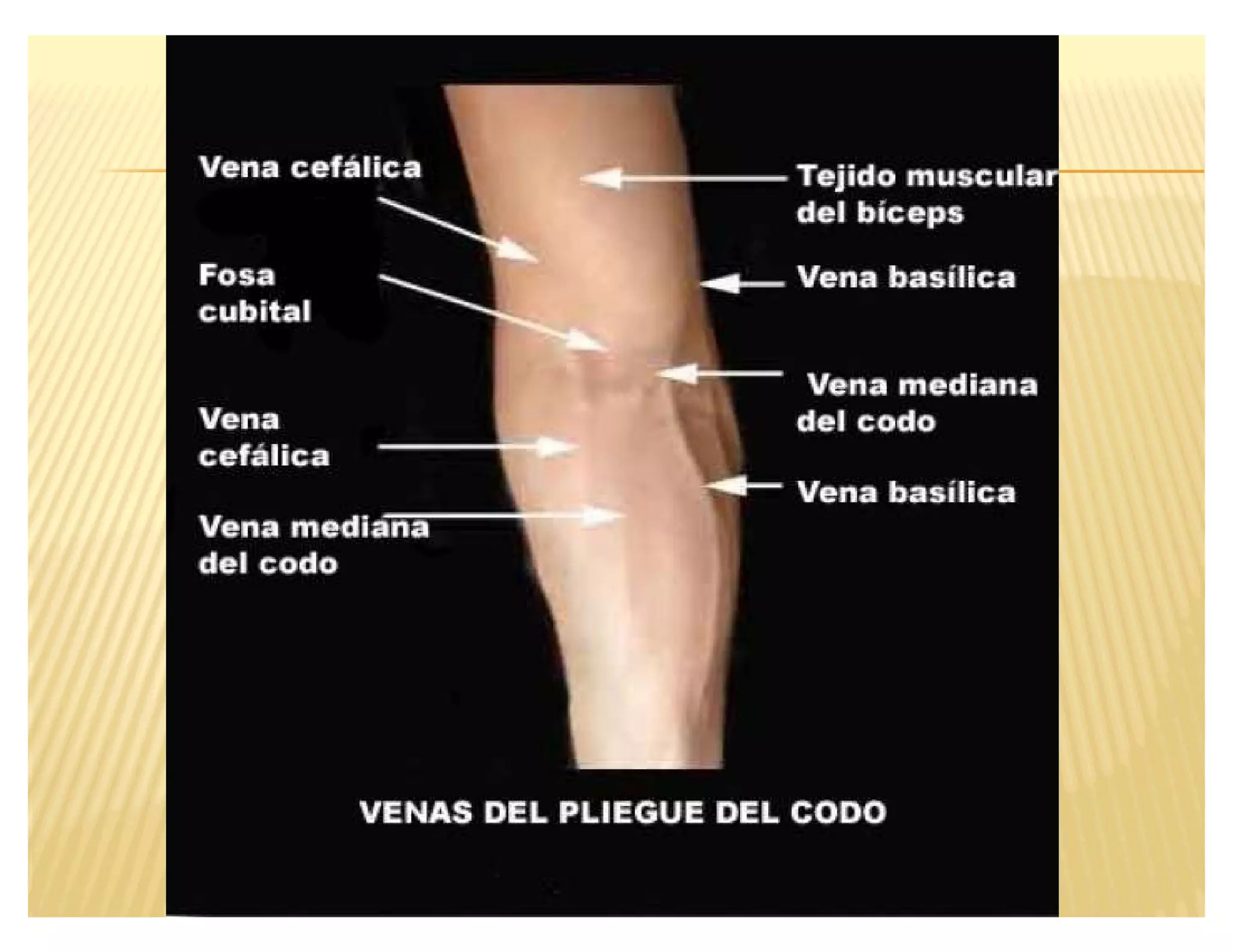 Exposicion del codo new | RTF