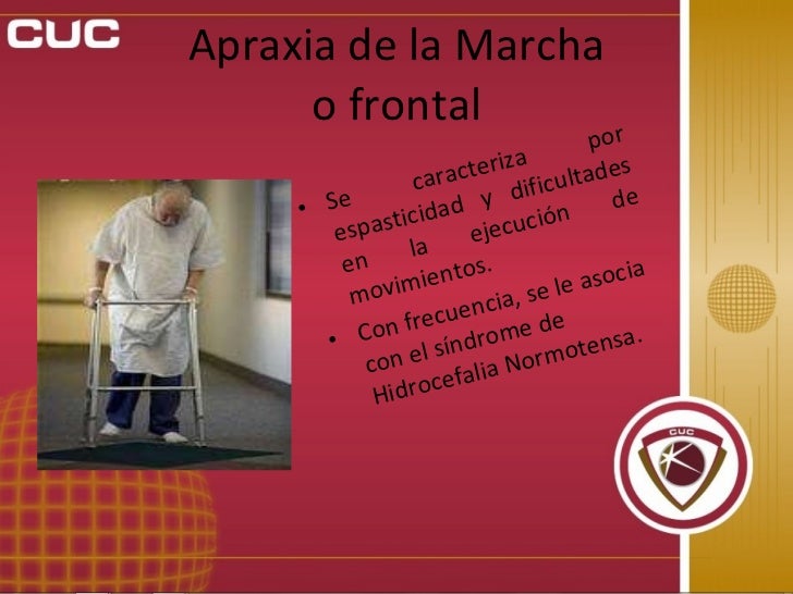 Clasificación de las apraxias