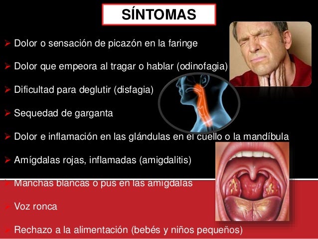 Remedios Caseros Para La Faringitis Qu Es La Faringitis
