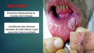 Comprehensive Overview of Syphilis: Definition, Stages, Diagnosis, and ...