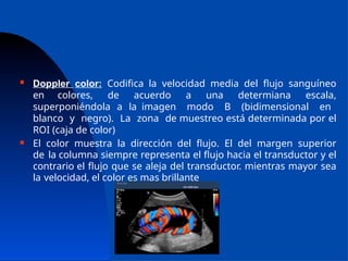 EXPOSICION ECOGRAFIA - generalidades.pptx