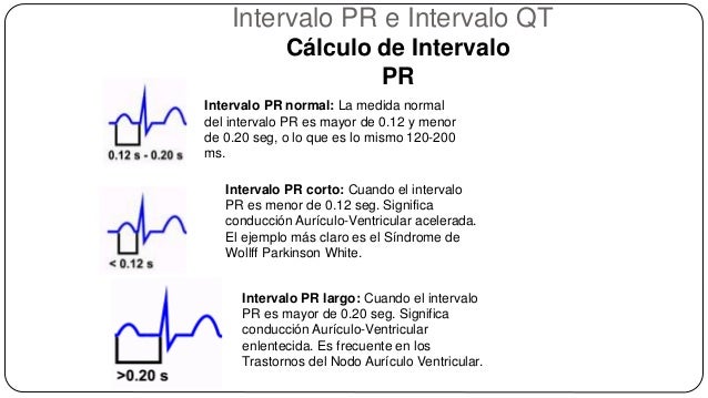 ELECTROCARDIOGRAFÍA NORMAL