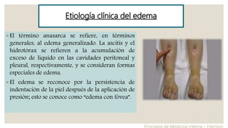 edema | PPTX