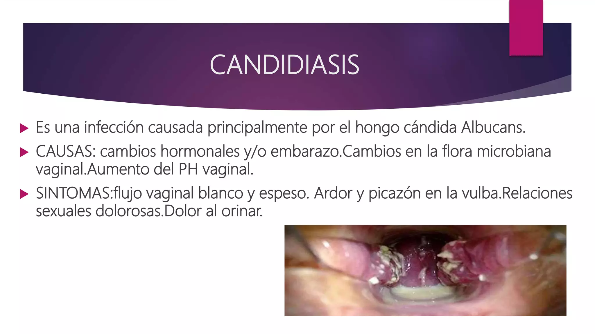 Exposicion flujos vaginales.pptx