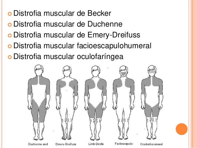 Exposicion informática
