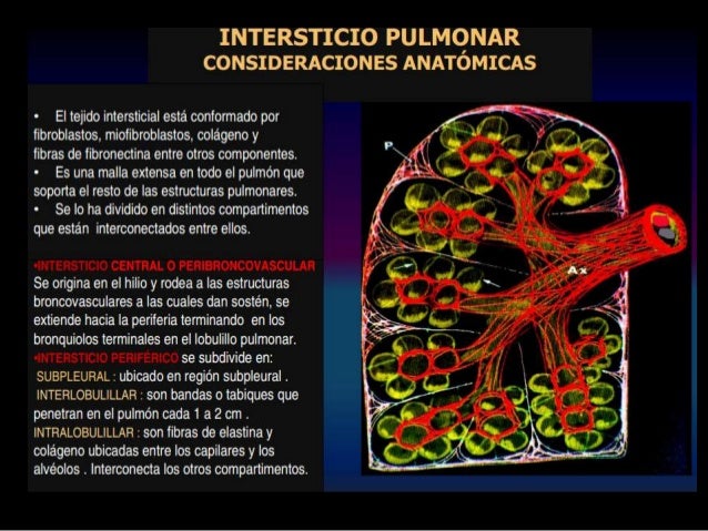 intersticio pulmonar
