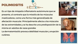 exposición miositis.pptx