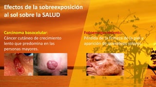 Exposicion solar y consecuencias. | PPTX