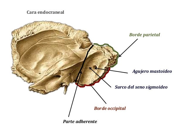 Exposicion temporal terminada