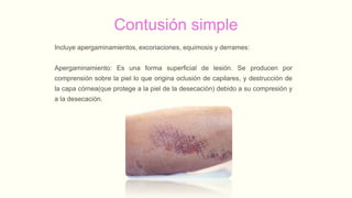 Estudio de la traumatologia forense | PDF