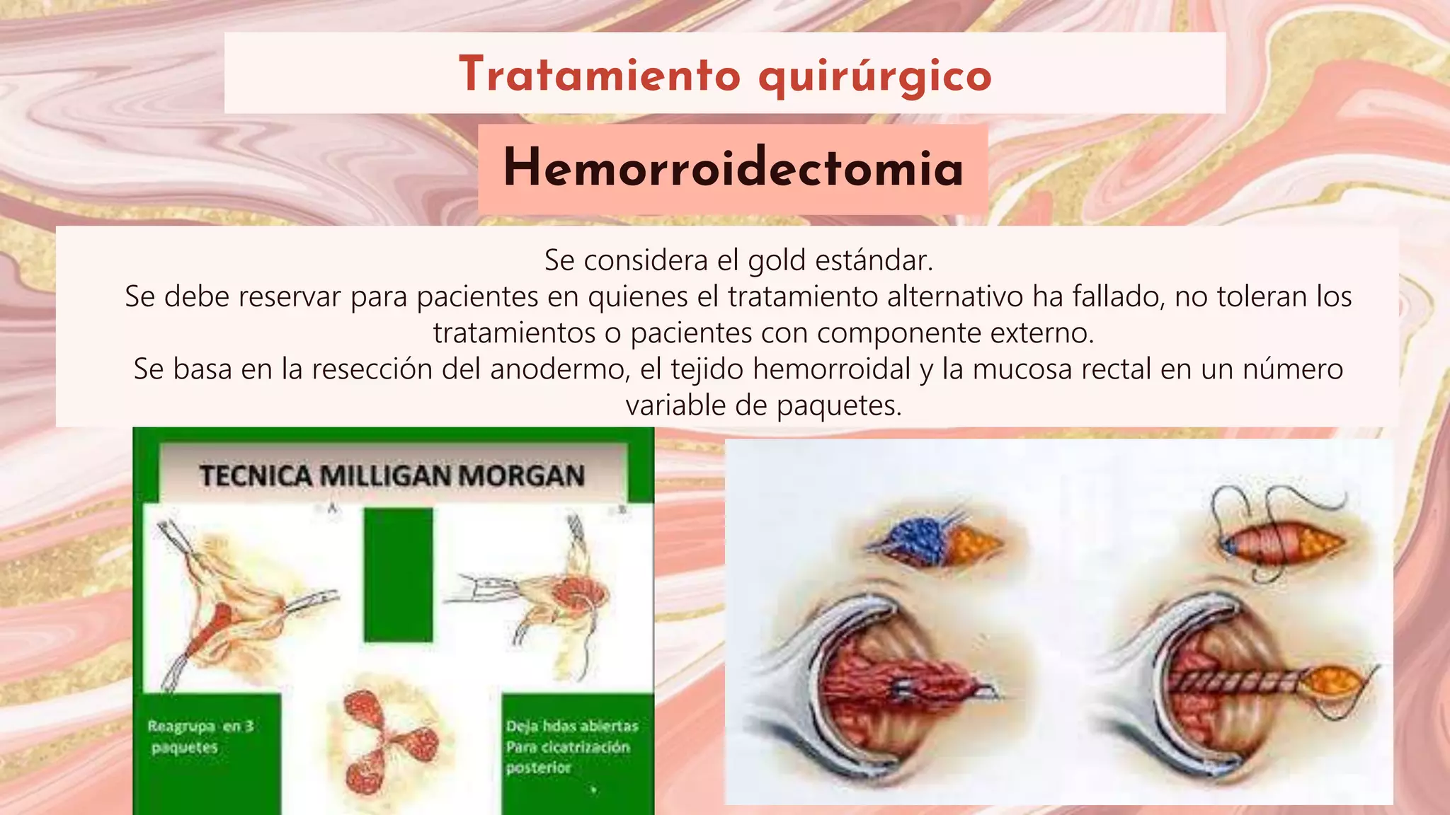 exposión hemorroides.pptx