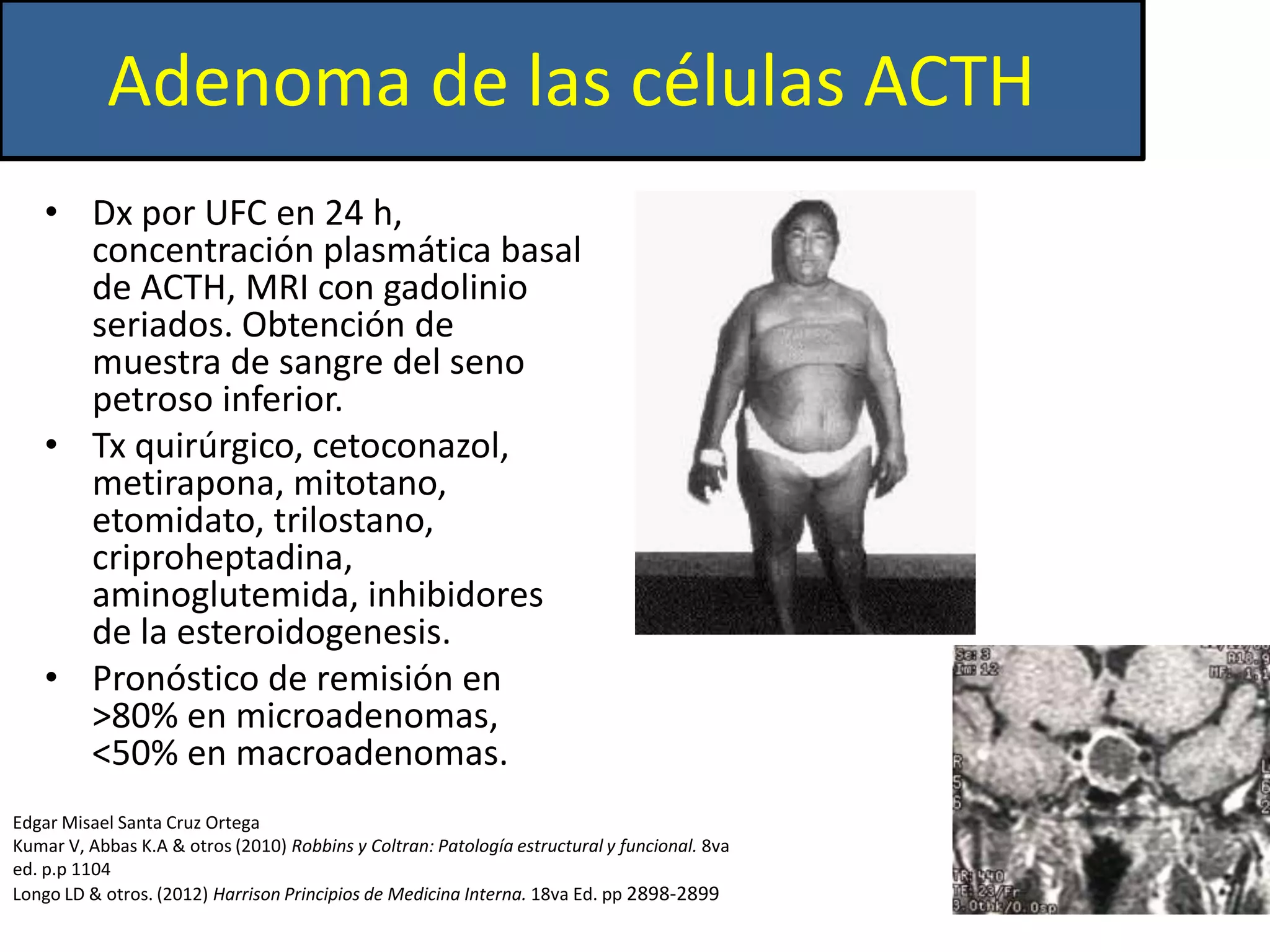 Patologias del sistema endocrino | PPTX