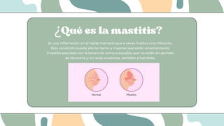 PPT de exposición de salud de la mujer(SJL) | PDF
