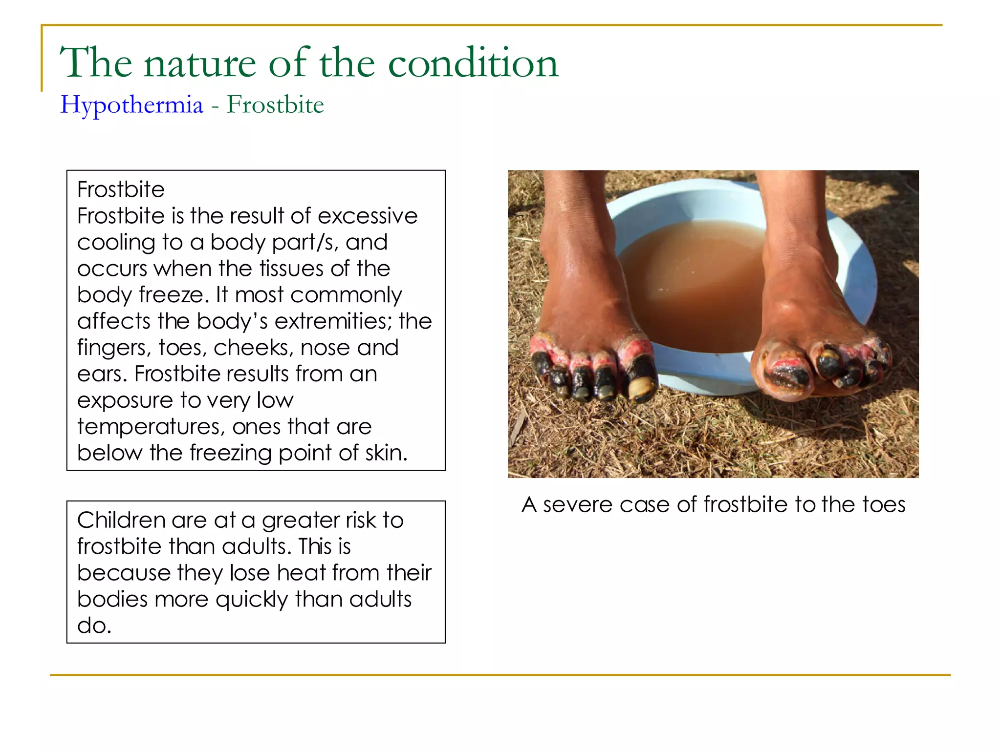 Exposure To Heat And Cold | PPT