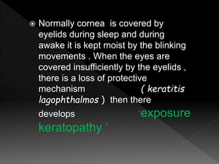 Exposure keratopathy | PPTX