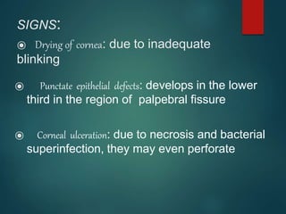 exposurekeratopathy.pptx