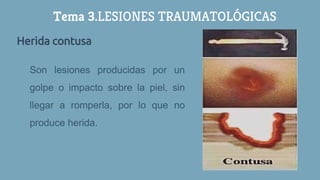 Funcion Medico Forense y lesiones traumatológicas | PPTX