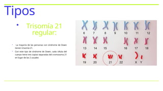 Expo Trisomia 21 Síndrome De Down Pptx