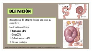 volvulo de sigmoides caracteristicas y clinica | PPTX