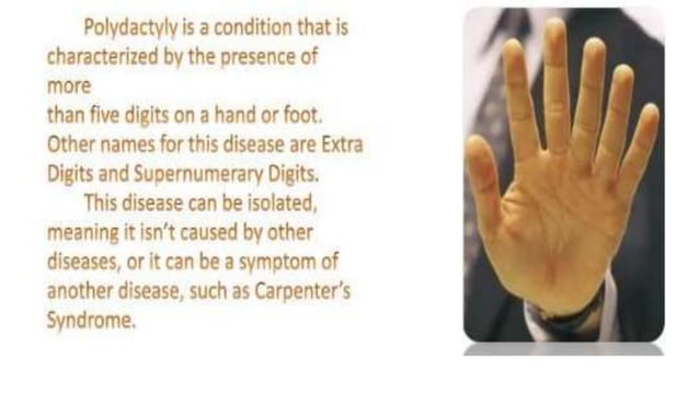 Expressivity | PPTX | Genetics | Science