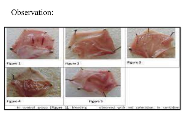 Expt 3 antiulcer activity by pyloric ligation method | PDF | Digestive ...