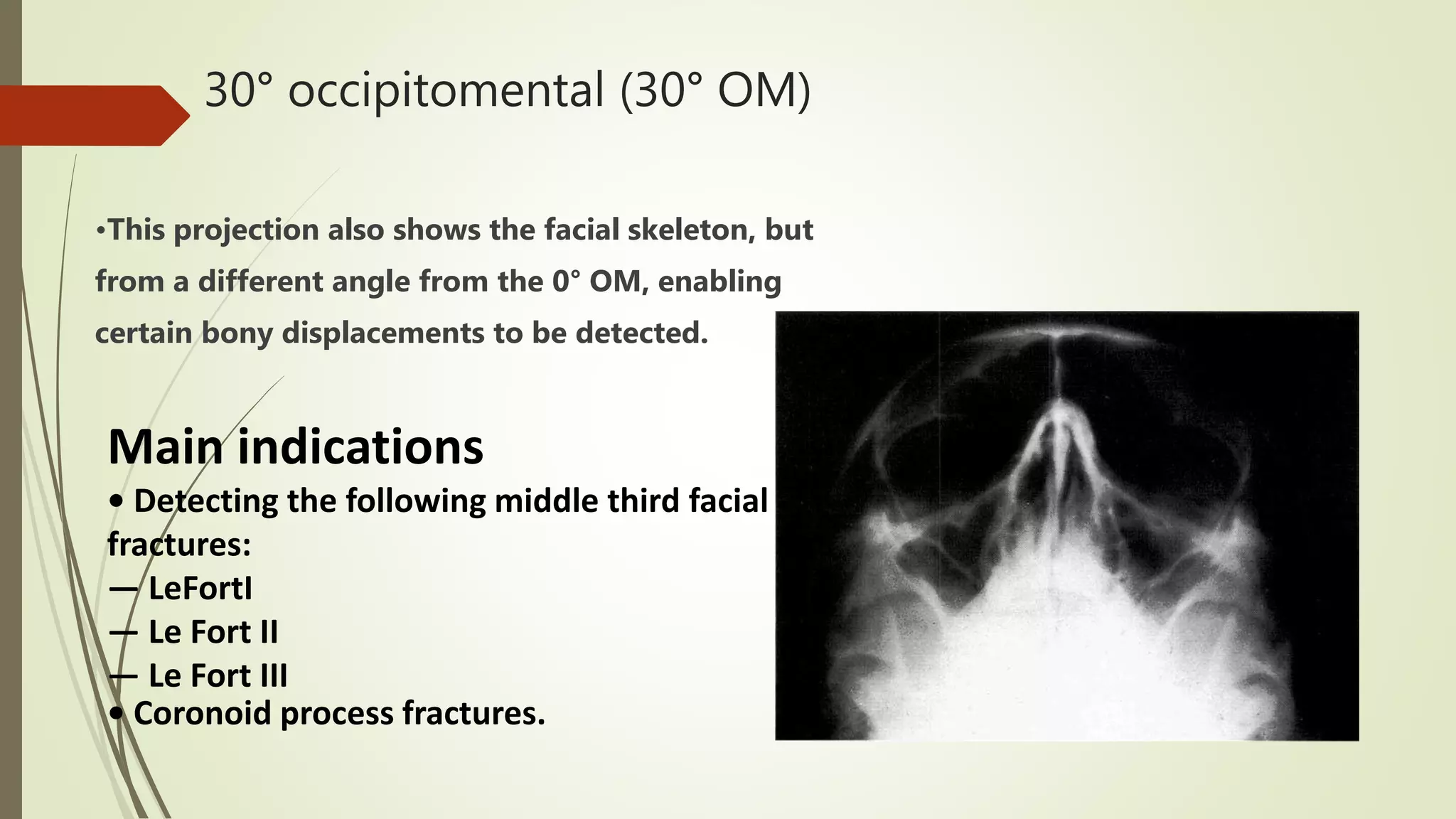 Exraoral and intraoral radiography | PPTX