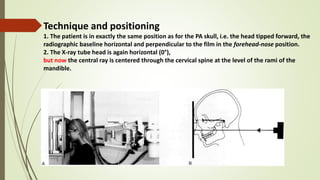 Exraoral and intraoral radiography | PPTX