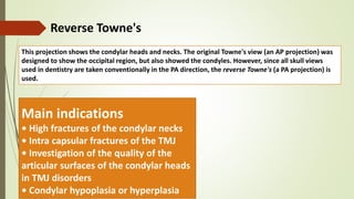 Exraoral and intraoral radiography | PPTX