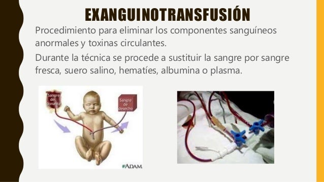 Exanguineotransfusion y fototerapia