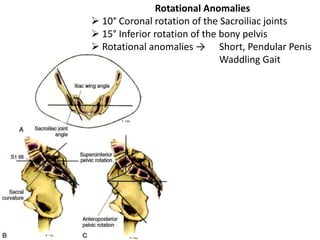 Exstrophy Epispadias complex | PPT