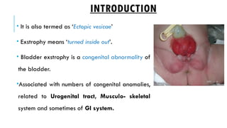 exstrophy of bladder/ urinary bladder extrophy.pptx