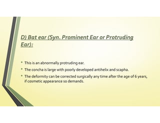 External ear abnormalities | PDF