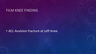 ACL INJURY | PPTX