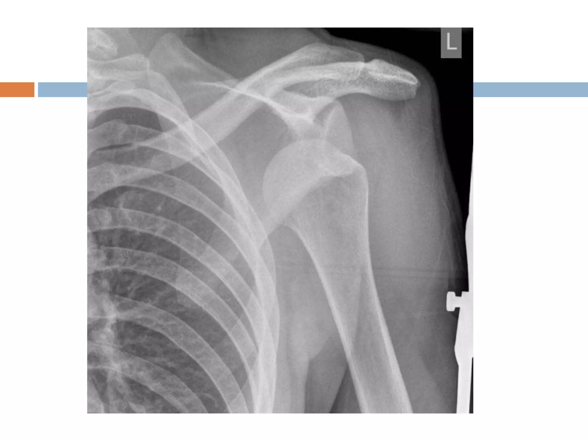 Ext conference ant shoulder dis | PPTX