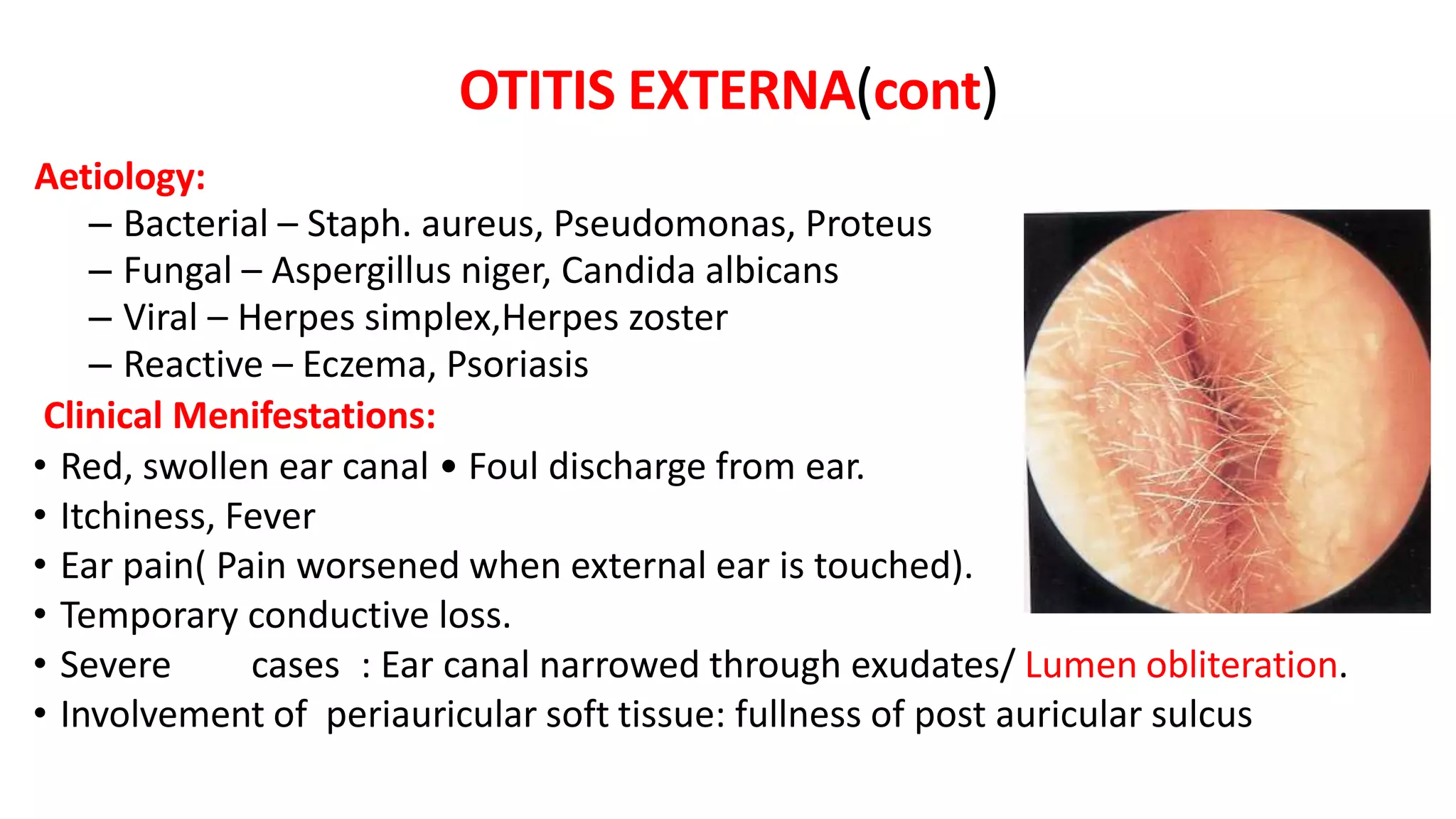 Diseases of External Ear | PPTX