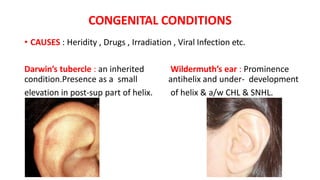 Diseases of External Ear | PPTX