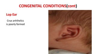 Diseases of External Ear | PPTX