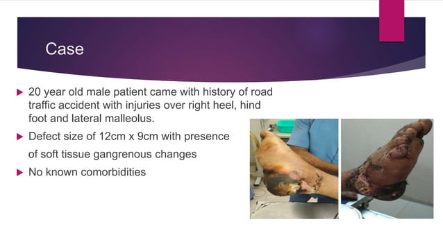 Extended-reverse-sural-artery-pedicle-flap.pptx