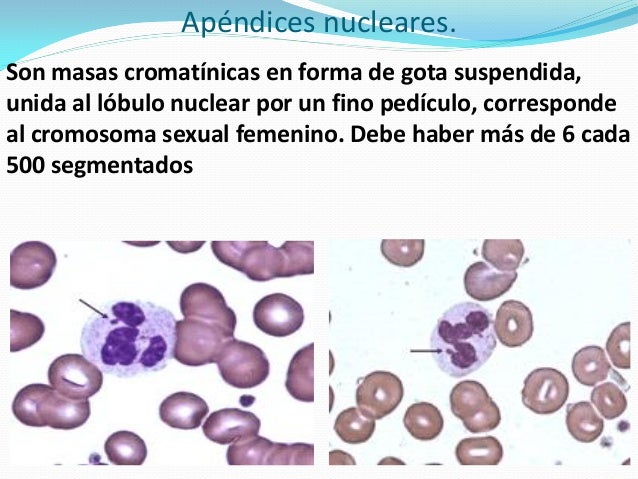 Extendido de Sangre Periferica Interpretación