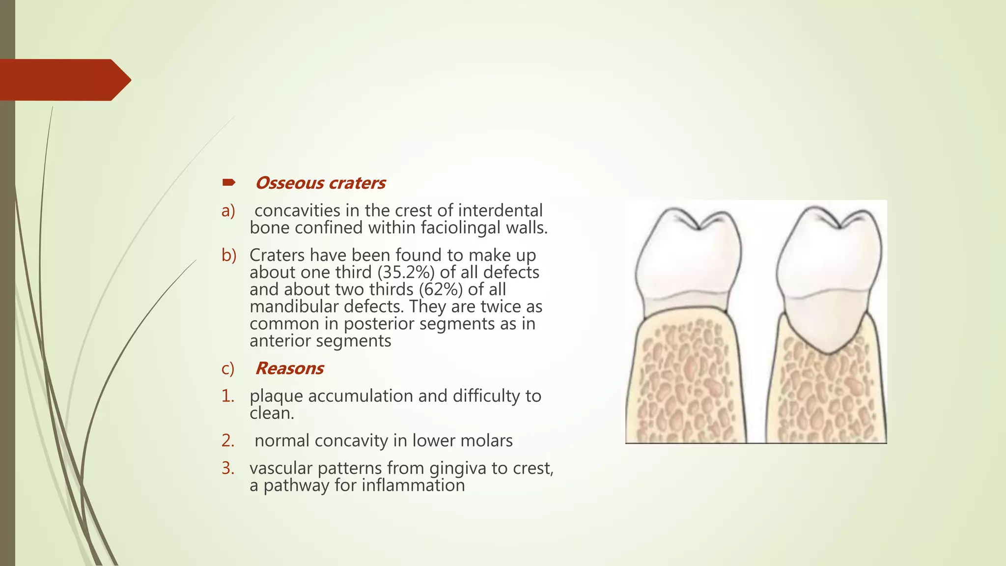 Extension of inflamation from gingiva to periodontal tissues and bone ...