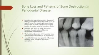 Extension of inflamation from gingiva to periodontal tissues and bone ...