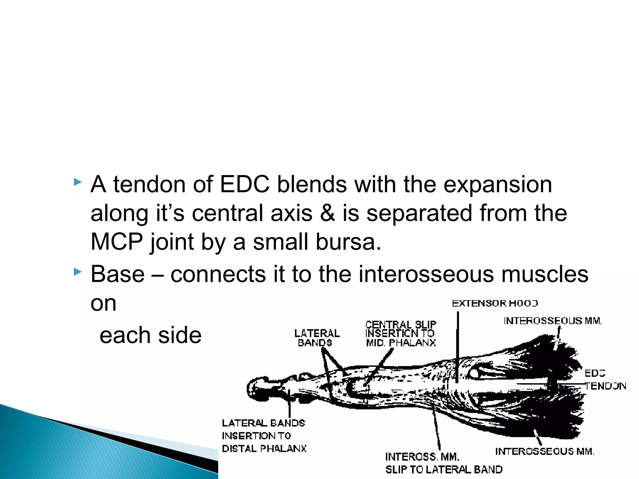 Extensor apparatus hand | PPT