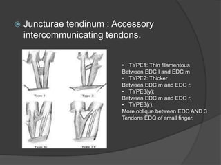 Extensorapparatusofhandinjuries | PPTX | Death, Injury, or Military ...