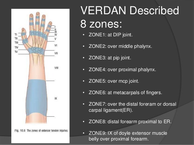 Extensorapparatusofhandinjuries