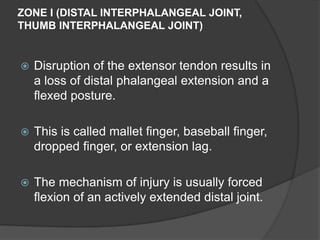 Extensor apparatus of hand injuries | PPTX