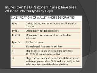 Extensor apparatus of hand injuries | PPTX
