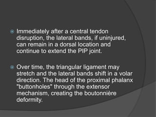 Extensor apparatus of hand injuries | PPTX